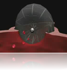 Atrial Fibrillation – What will be the future standard of care ...